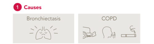 Differences Between Bronchiectasis and COPD | SmartVest