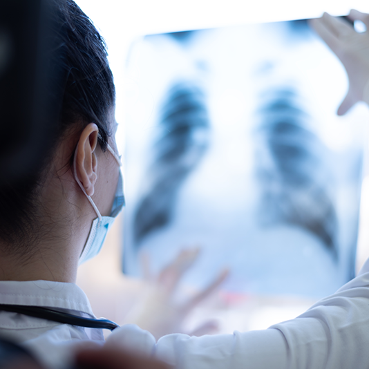 Pulmonary Doctor: When To See a Lung Specialist | SmartVest