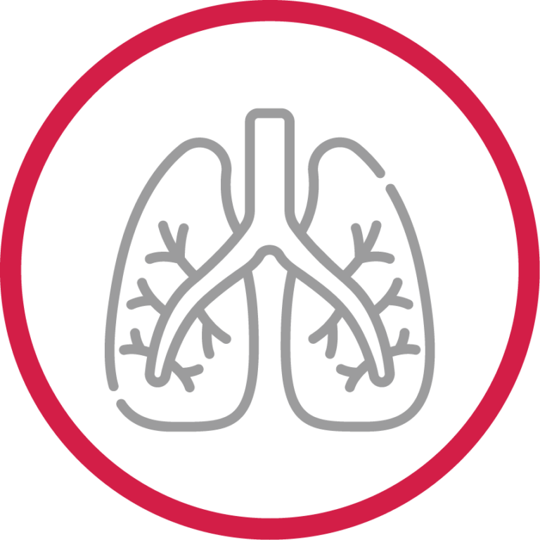 What Is a Flare Up or Acute Exacerbation? | SmartVest